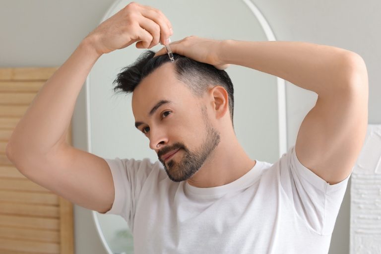 Hair Loss Solutions: Natural Alternatives to Minoxidil - Faithful To Nature